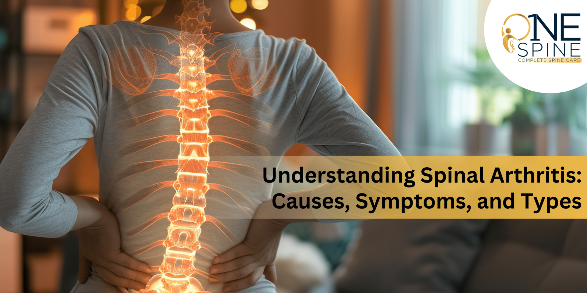 Understanding Spinal Arthritis: Causes, Symptoms, Types